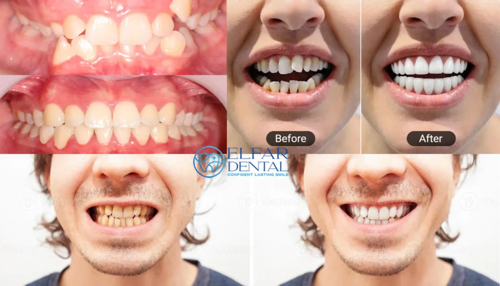 The Smile Makeover Guide Find Your Perfect Cosmetic Dentistry