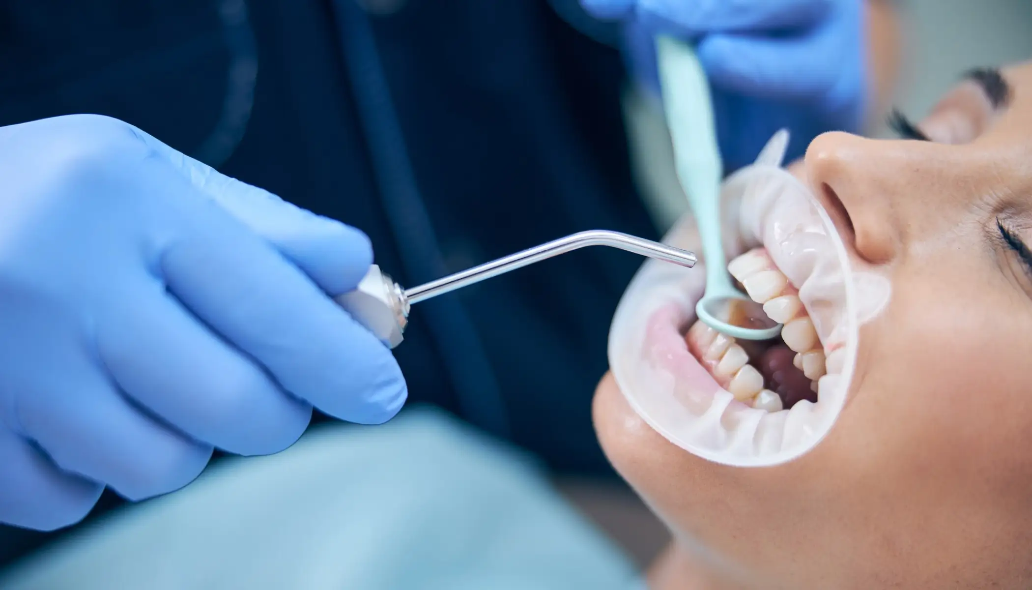 Emergency Dentist Belconnen | Same-Day Tooth Pain Relief – Elfar Dental